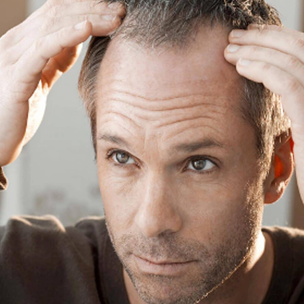 Hair loss - Ihr Hautarzt