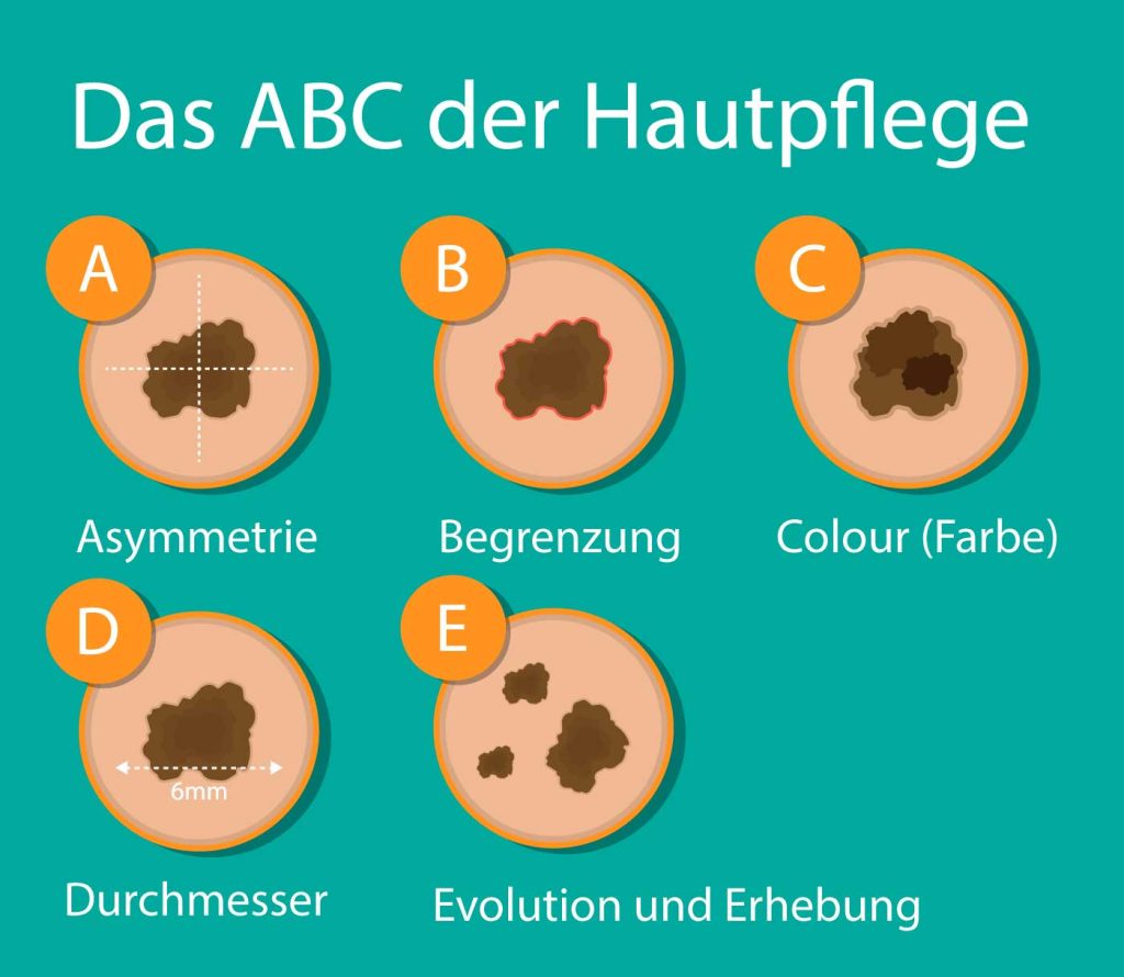 Hautkrebs - Ihr Hautarzt