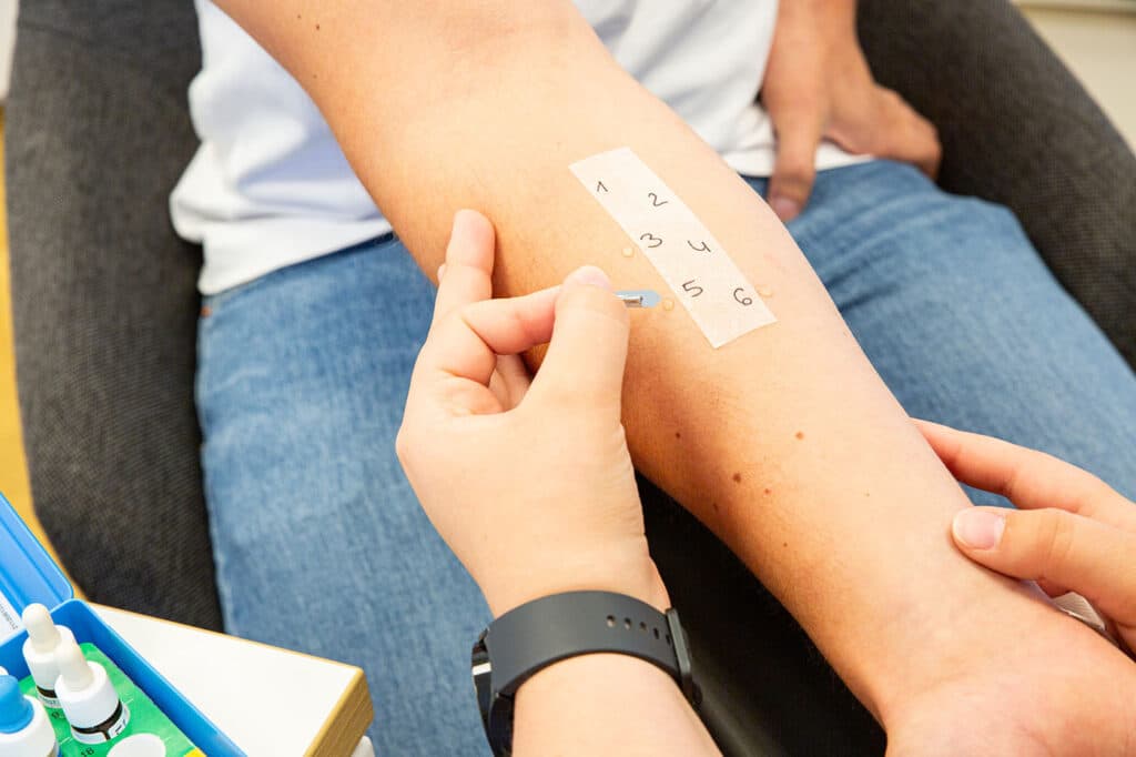 Allergologie - Desensibilisierung & Allergietest Frankfurt